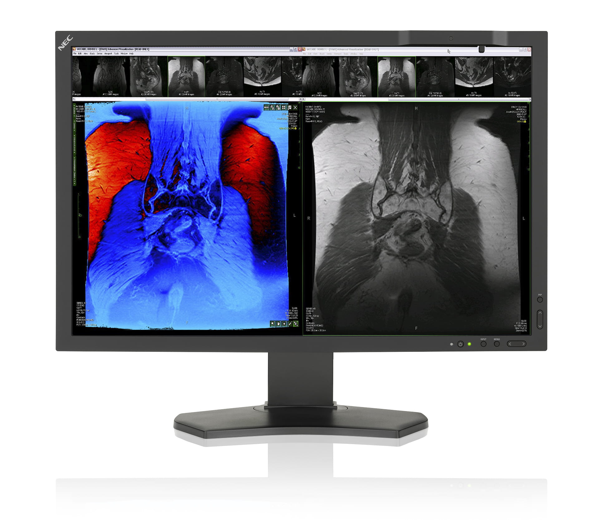 NEC MD242C2 - www.wyswietlanie.com.pl